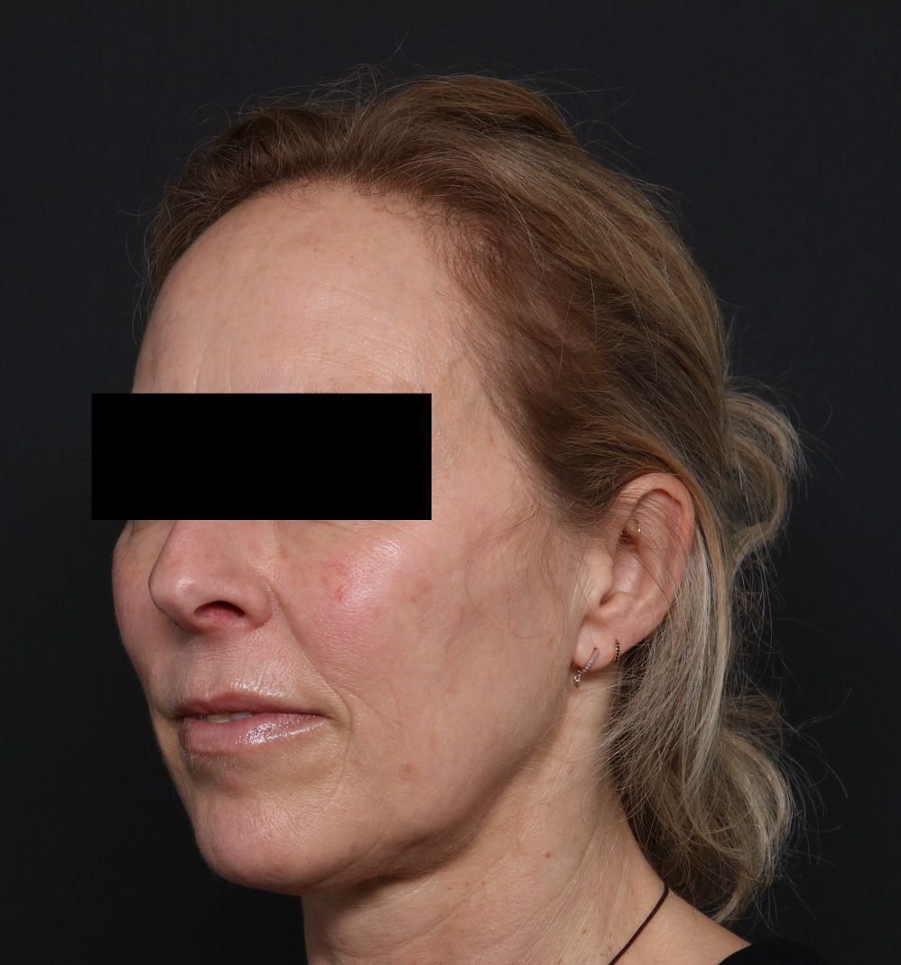 Define Clinic | Aesthetic Clinic London And Beaconsfield